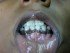 Oral Pigmentation (Causes of Discoloration Inside Mouth) - Healthhype