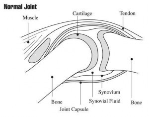 Types of Arthritis | Healthhype.com