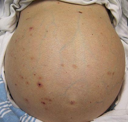 Conditions | Healthhype.com