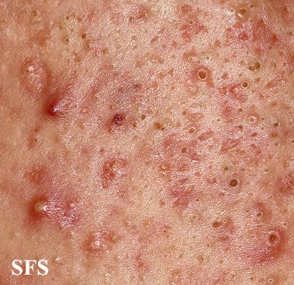 Itchy Chest - Causes, Pictures and Other Symptoms - Healthhype