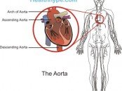 Enlarged Aorta - Causes, Symptoms of an Aortic Aneurysm - Healthhype