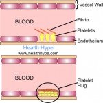 Scab (Skin Wound) - Formation Process, Causes, Pictures, Care - Healthhype