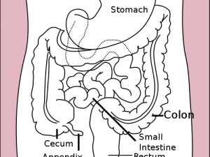 Slow Bowels and Bowel Movements Meaning, Symptoms and Causes - Healthhype