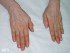 Skin Discoloration, Causes, Pictures of Abnormal Skin Colors - Healthhype