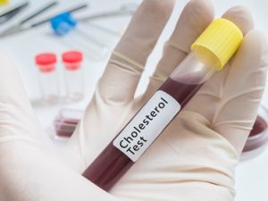 Dangerous Cholesterol Levels, Types, Dangers and Risks - Healthhype