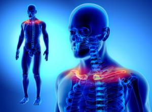 Swollen Clavicle (Collarbone Swelling) Causes and Symptoms - Healthhype