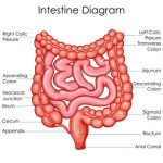 Colon Mass Symptoms, Types and Causes - Healthhype