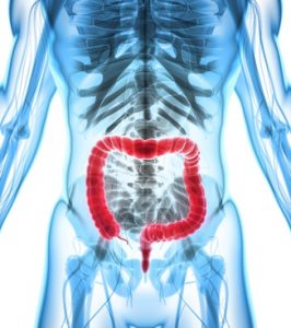 Blocked Bowels (Colon) - Small or Large Intestine Obstruction - Healthhype
