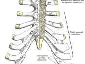 Severe Costochondritis - Causes, Symptoms, Treatment - Healthhype
