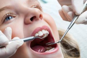 Inflamed Mouth (Stomatitis) Causes, Symptoms, Treatment - Healthhype