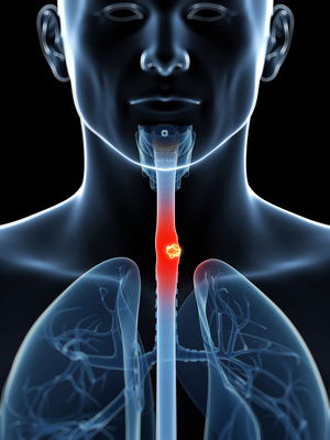 Esophagus Problems and Esophageal Pain - Healthhype