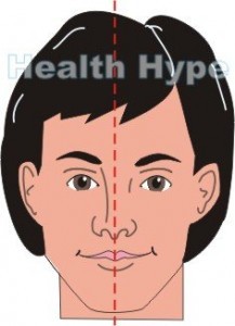 One Sided Facial Swelling (Swollen Face on One Side) - Healthhype