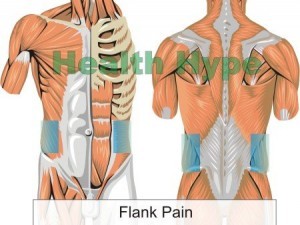 flank pain Archives - Healthhype