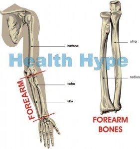 Forearm Pain (Lower Arm) Causes - Muscles, Bones, Joints, Nerves ...