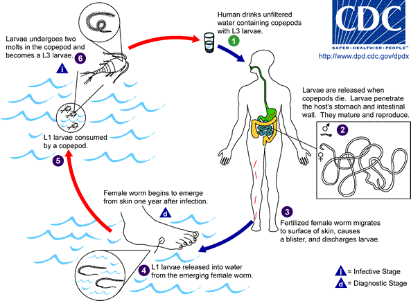 Dracunculiasis (Guinea Worm Disease) | Healthhype.com