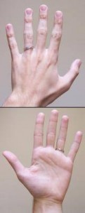 6 Finger Problems That Causes Pain & Stiffness - Healthhype