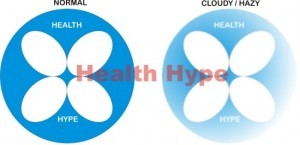 Dim Vision (Dull Eyesight) Causes, Diseases and Treatments - Healthhype