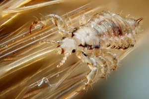 Scalp Problems (Head Skin) Pictures, Causes and Treatment - Healthhype