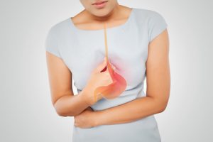 Esophagitis (Inflamed Esophagus) Types, Causes, Symptoms - Healthhype