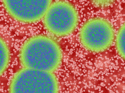 CD4 Count - Normal (Healthy), HIV, AIDS and Zero Levels - Healthhype