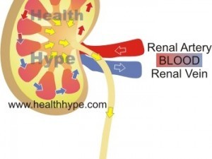 Lithium Induced Kidney Disease (Nephropathy) - Healthhype