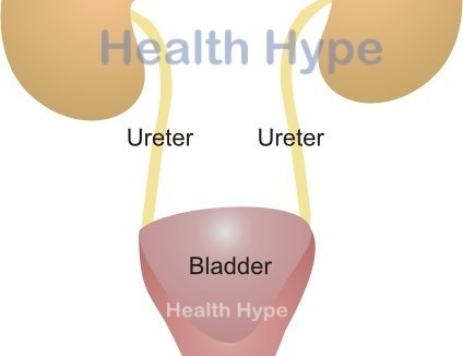 Pyonephrosis (Pus Collection in the Kidney) - Healthhype