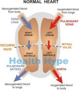 Supraventricular Tachycardia (SVT) - Healthhype