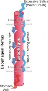 Esophagus Problems and Esophageal Pain | Healthhype.com