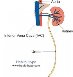 Kidney Pain Location, Causes and Symptoms - Healthhype
