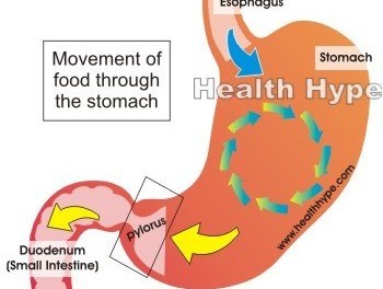Gastroparesis (Stomach Paralysis and Slow Stomach Emptying) - Healthhype