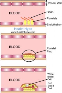 What is a Thrombus? Thrombosis Causes in Artery and Vein - Healthhype