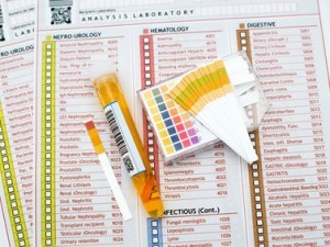 Cloudy Urine Causes And What Does Murky Urine Mean? - Healthhype